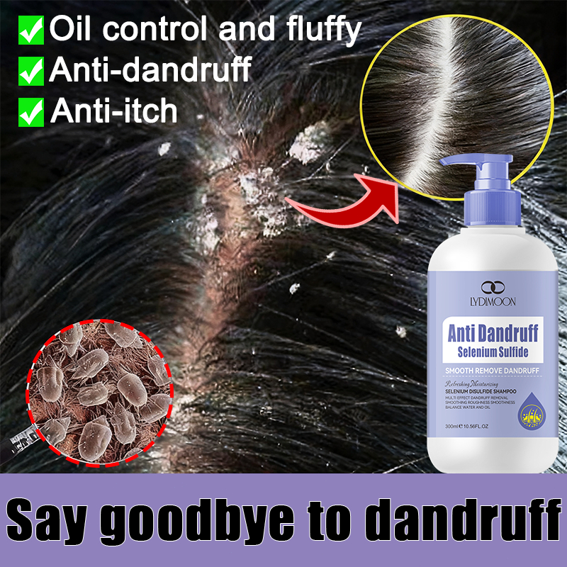 Anti-dandruff and anti-itch shampoo Selenium sulfide shampoo Removes ...