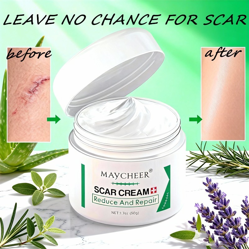 50G Authentic Scar Removal Cream | Leg Old Scar & Peklat Eliminator ...