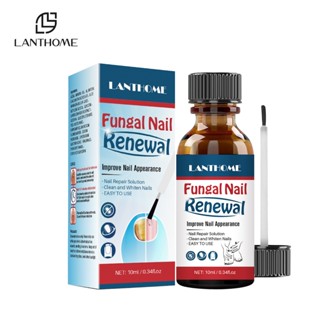 LANTHOME Fungal Nail Treatment 10ml | Gamot sa Buni sa Kuko ...