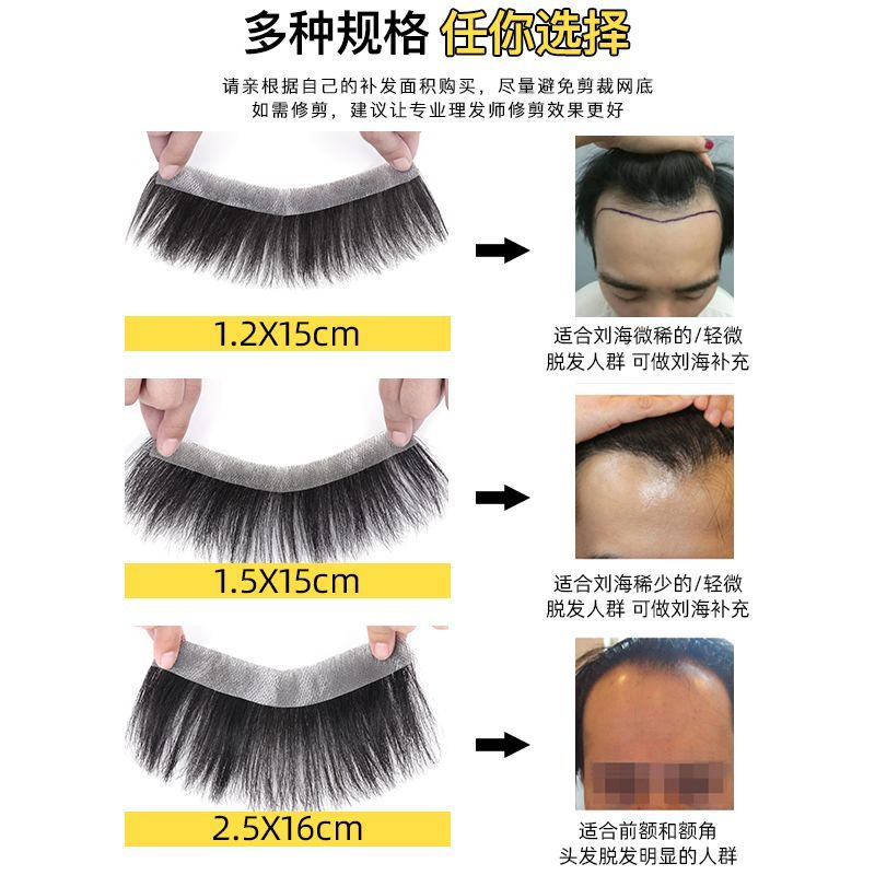 Hairline wig stickers men s forehead thin m-shaped biological scalp no ...