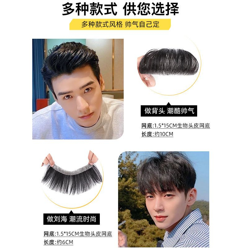 Hairline wig stickers men s forehead thin m-shaped biological scalp no ...