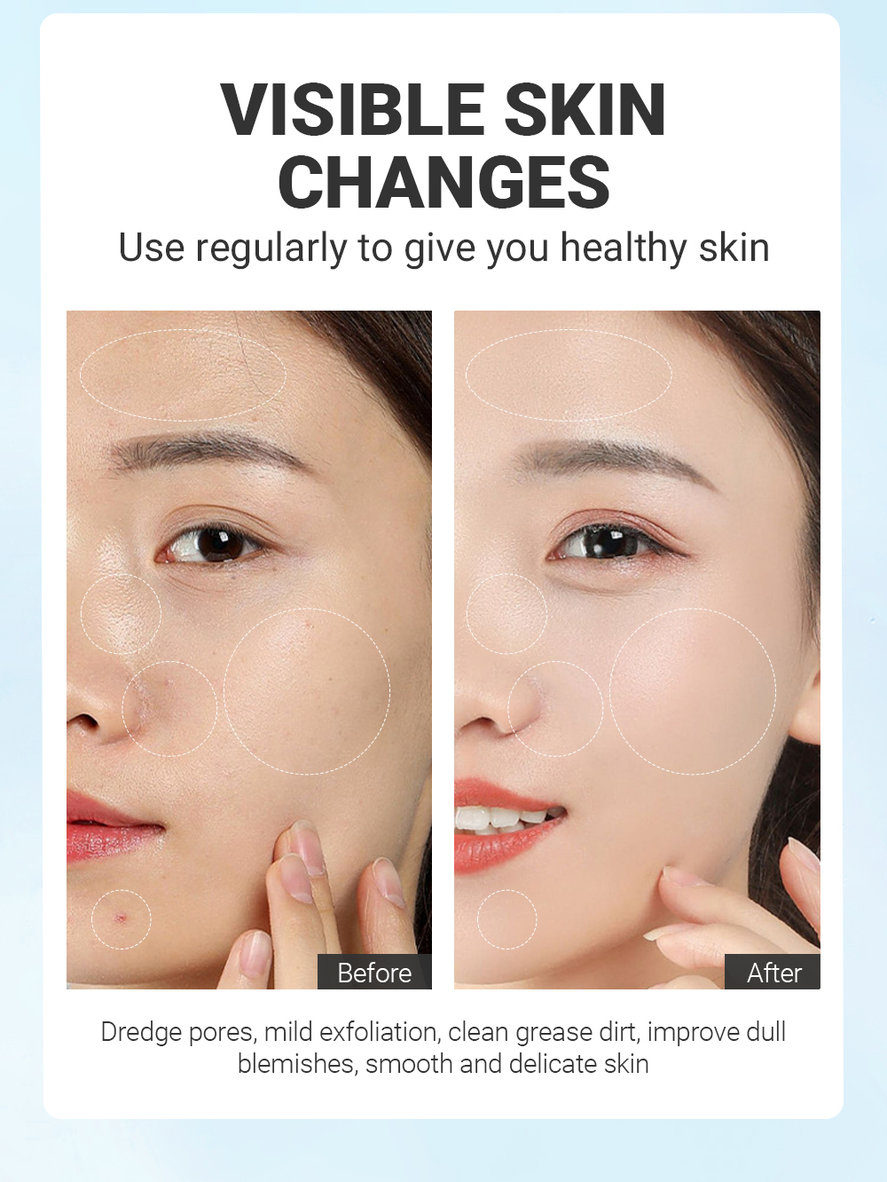 MUSWINT Niacinamide Whitening Facial Cleanser Oil Control Acne ...