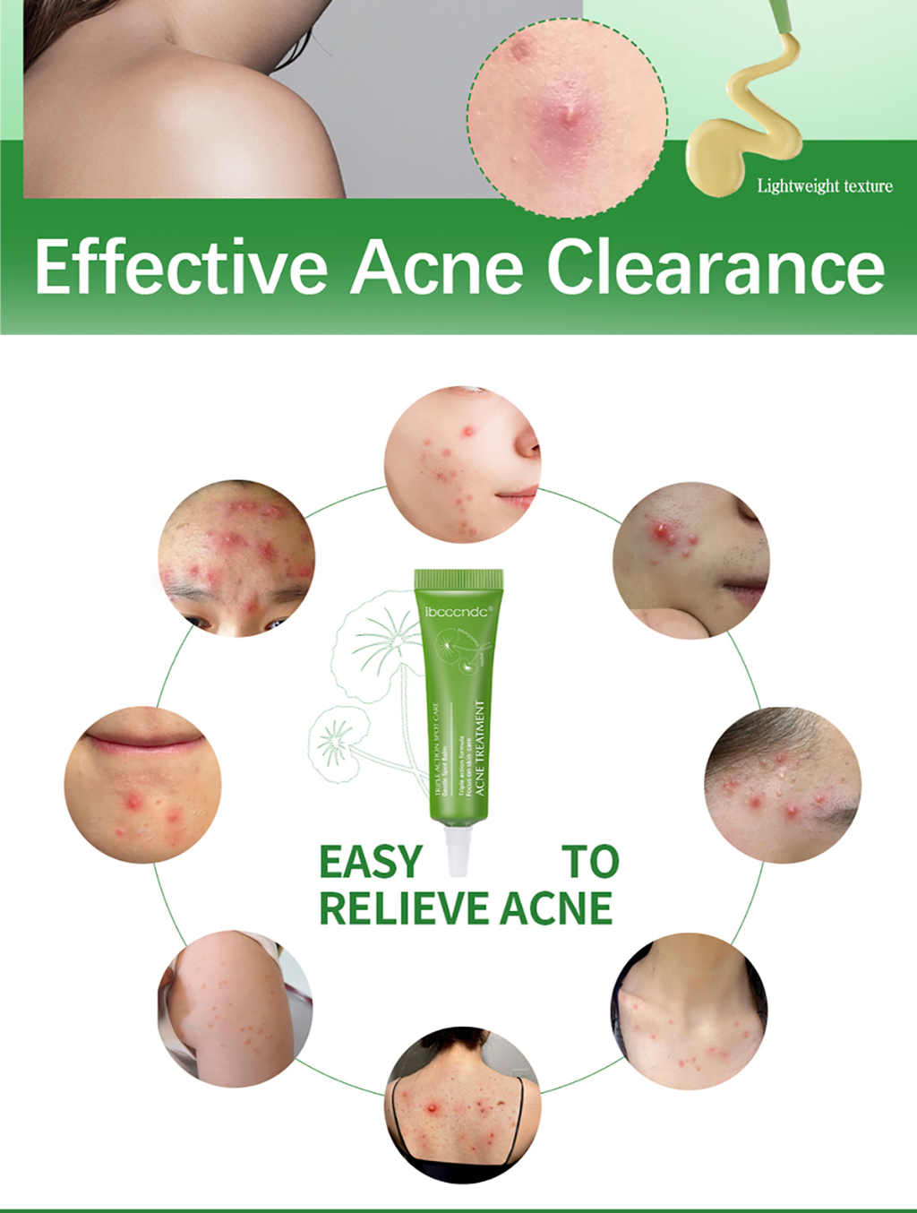 IBCCCNDC Acne Plus Triple Action Spot Care Balm Anti Scar Pimple Eraser ...