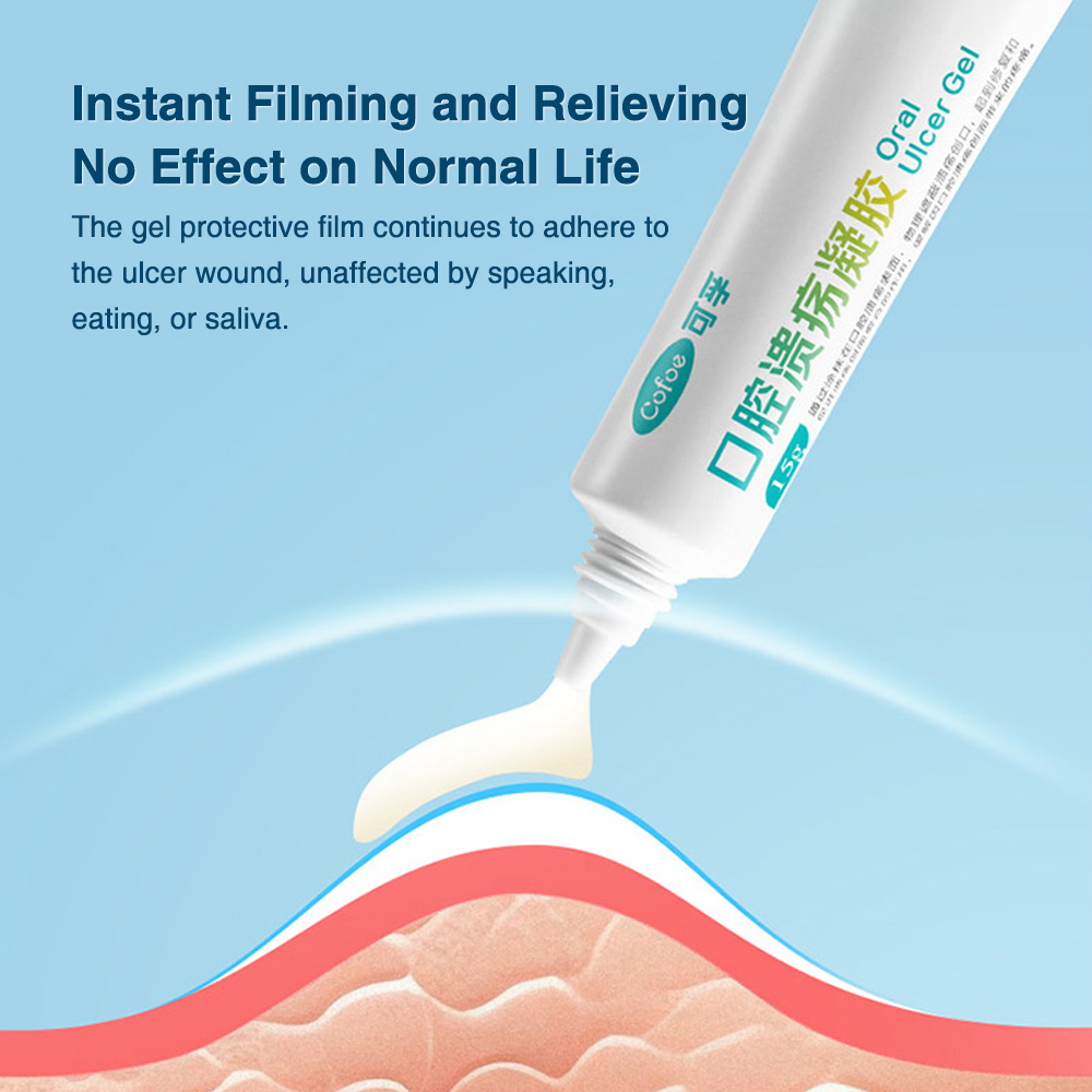 Cofoe Oral Ulcer Gel Mouth Ulcer Treatment Canker Pain Relief Aphthous ...