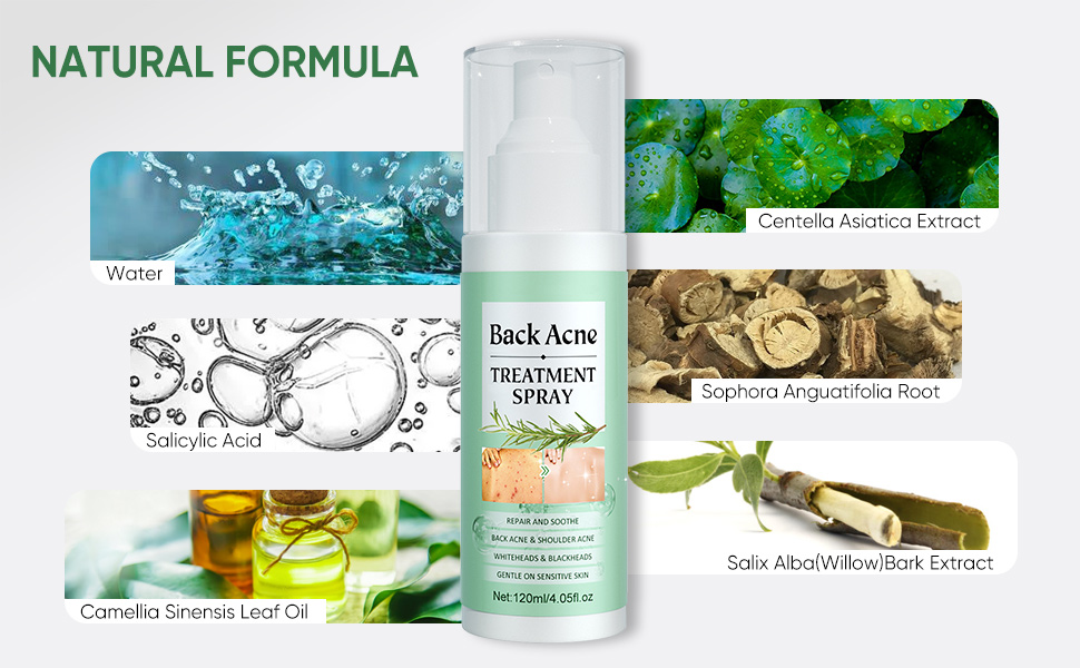 Back Acne Treatment Spray - Herbaluxy Back Acne Spray, 2% Salicylic ...