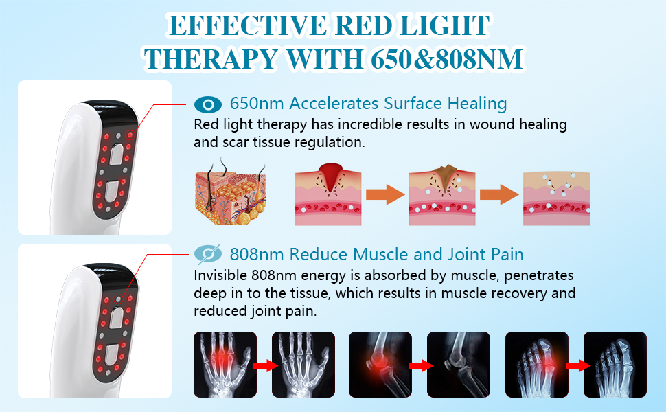 KTS Upgraded Percutaneous Electrical Nerve Stimulation Equipment (TENS ...