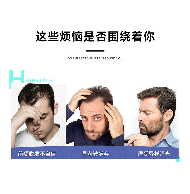 Hairline wig stickers forehead men s high forehead men s bald wig piece ...