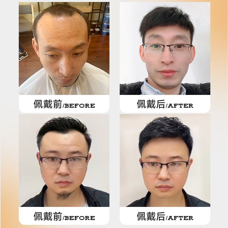 Hairline wig stickers forehead men s high forehead men s bald wig piece ...