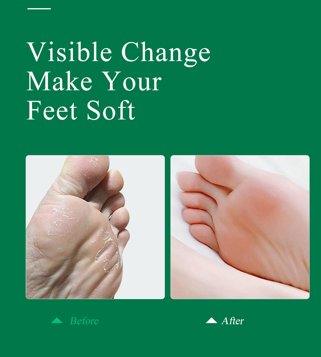 MABREM Foot Treatment Cream Anti Cracking Moisturizing Foot Care Anti ...