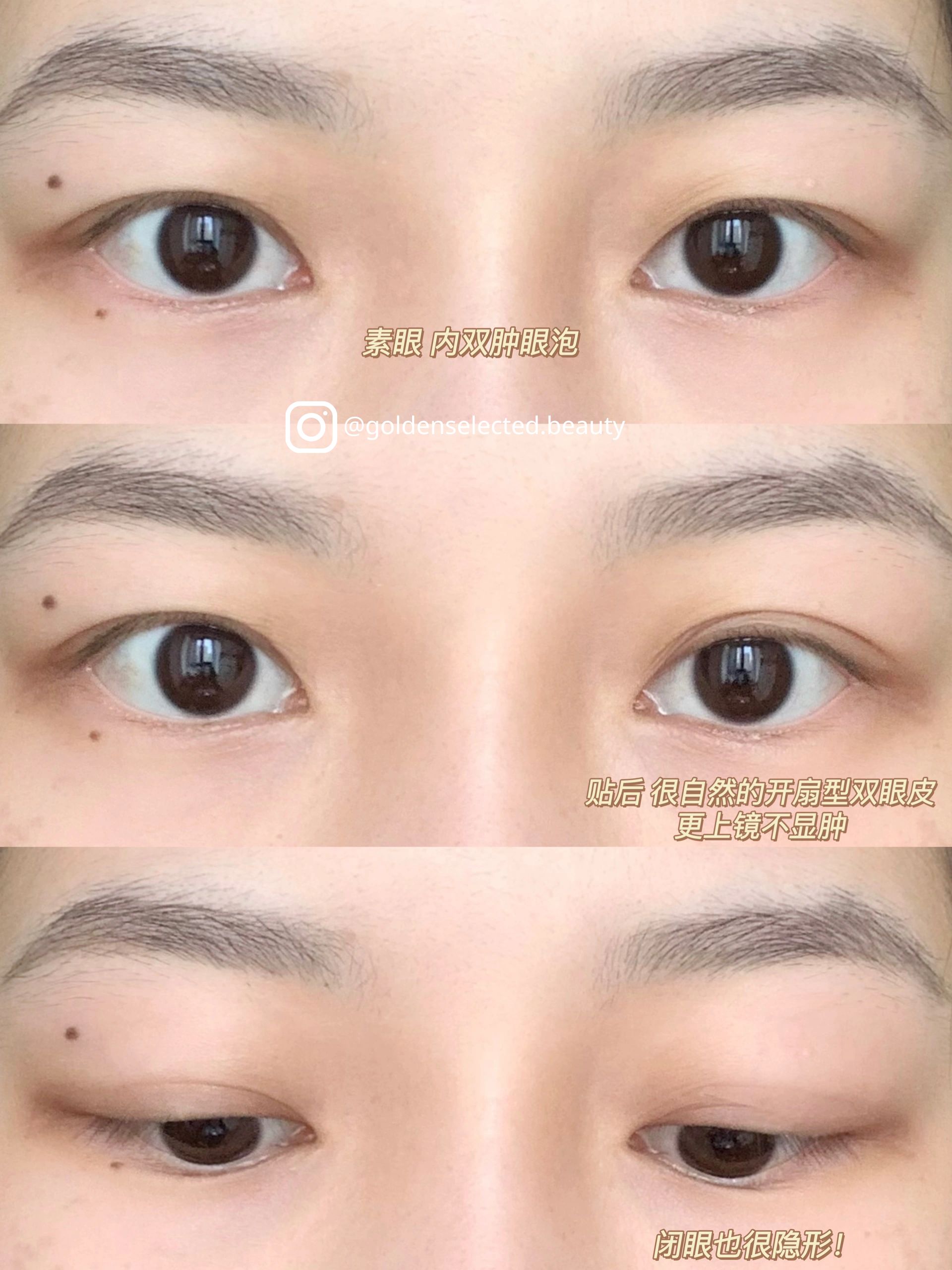 FLORTTE double eyelid patch (120 patches) Floria MIKKO co branded mesh ...