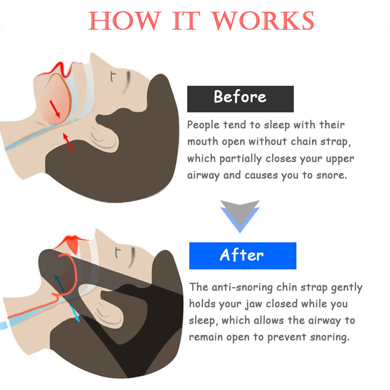 [Local Shipment] Unisex Stop Snoring Strap,Anti Snoring Chin Belt,Stop ...
