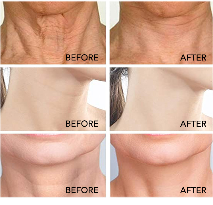 lerfm neck whitening cream LERFM Hexapeptide Niacinamide Firming and ...