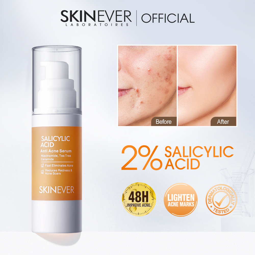 SKINEVER Salicylic Acid Skin Care 3pcs Set Acne Removal Essence Skin ...
