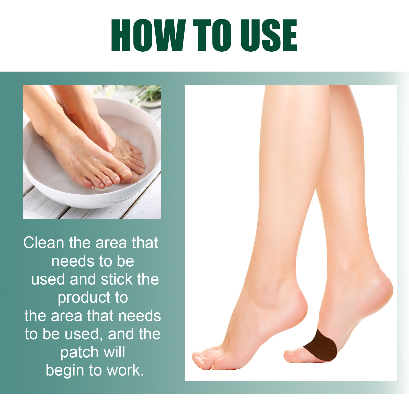 EELHOE Bunion Treatment Patch Thumb Corrector Reduce Uric Acid Relieve ...