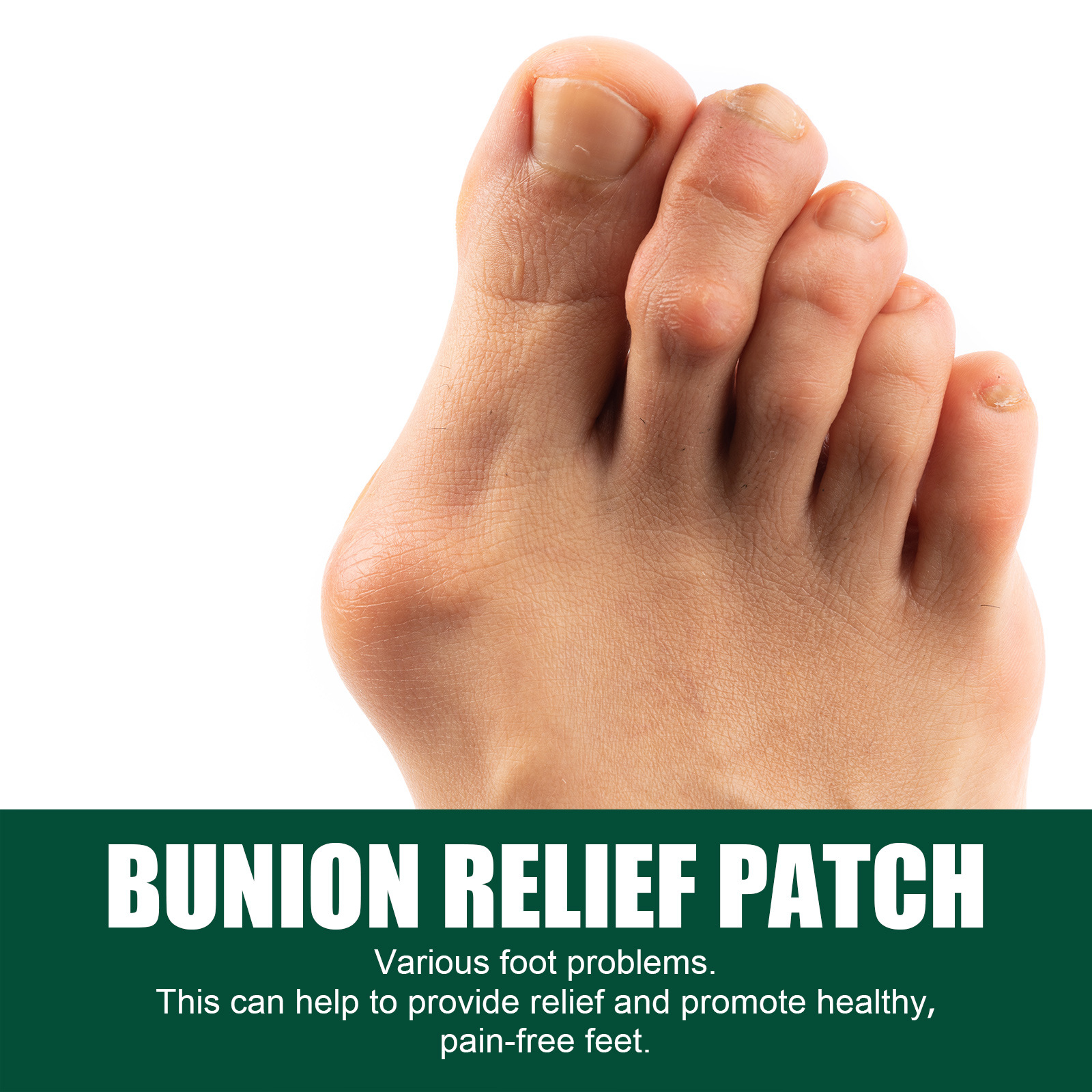 EELHOE Bunion Treatment Patch Thumb Corrector Reduce Uric Acid Relieve ...