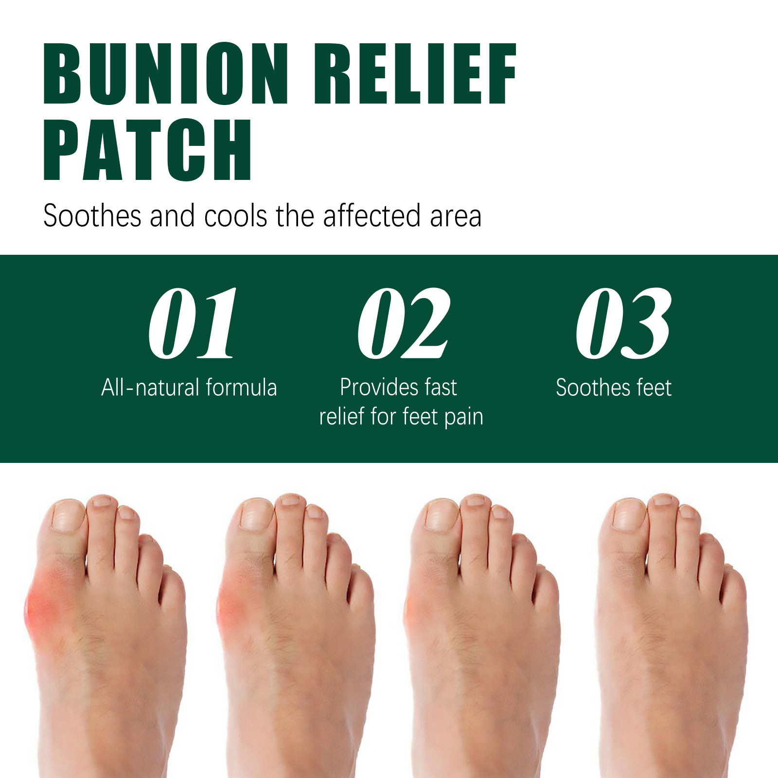 EELHOE Bunion Treatment Patch Thumb Corrector Reduce Uric Acid Relieve ...