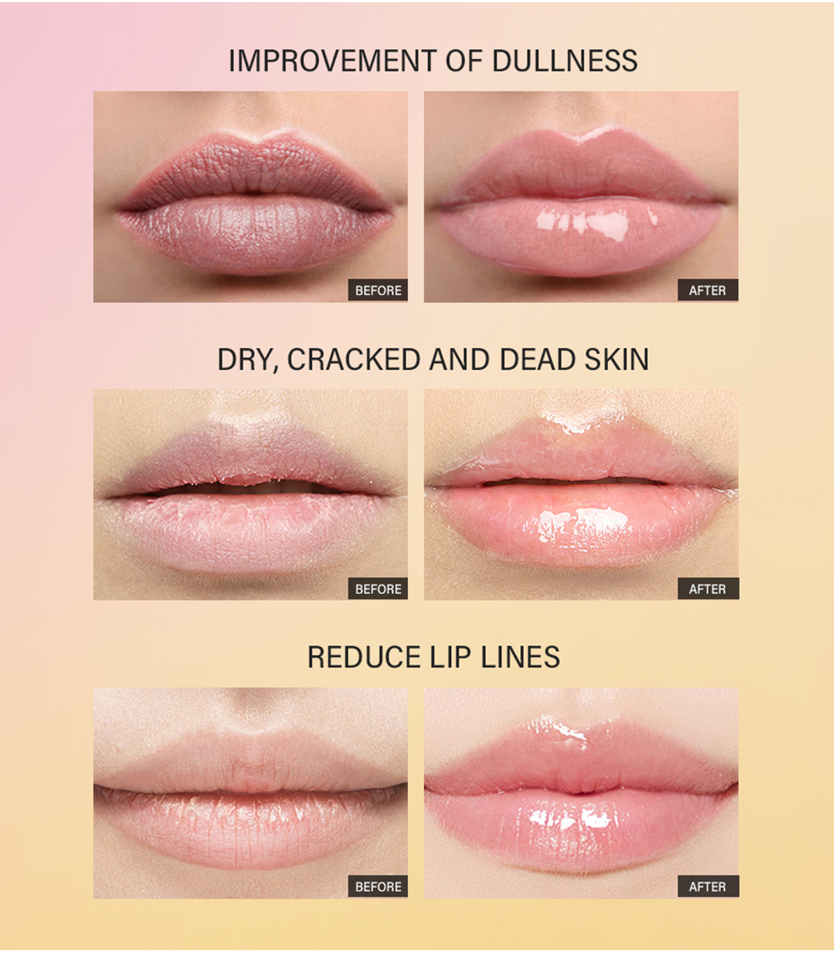 Lakerain Peptide Lip Treatment Moisturizing Lip Mask Gel To Remove Dead ...