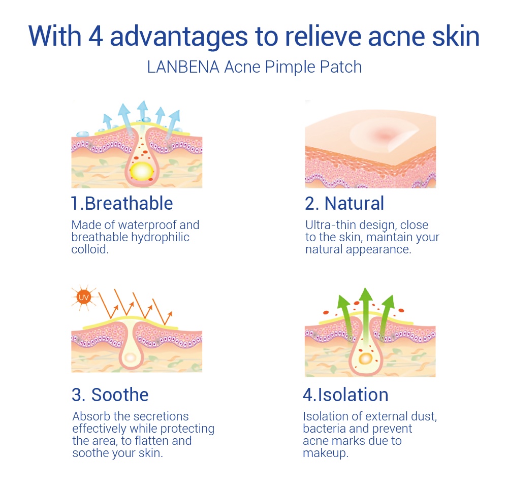 Lanbena Pimple Patch Acne Treatment Patch Acne Stickers Blemish Pimple ...