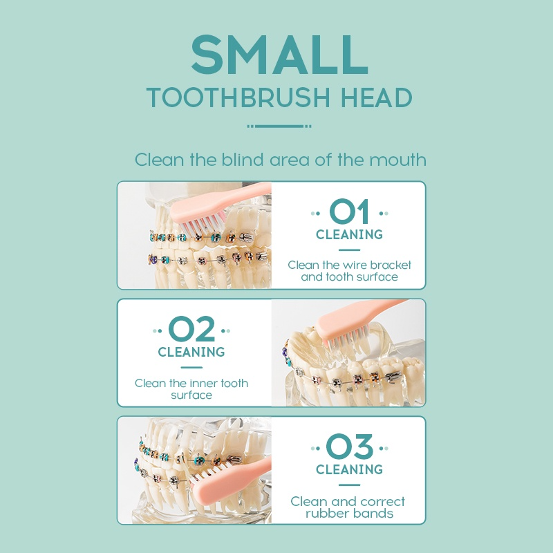 MEYARN P V 3PCS Orthodontic Braces Toothbrush with Soft Brush Concave ...