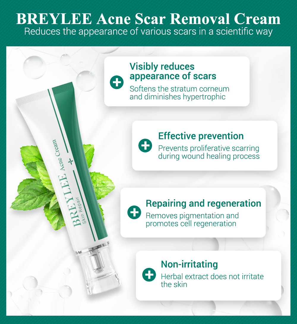 BREYLEE Acne Cream Scar Repair Gel Pimple Acne Treatments Scar Acne Remove Cream Fade Marks ...