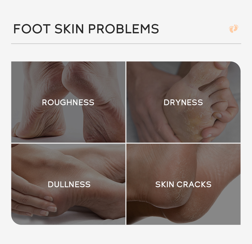QUIYUM Milk Honey Foot Wax Peel Off Mask Exfoliating Softening ...