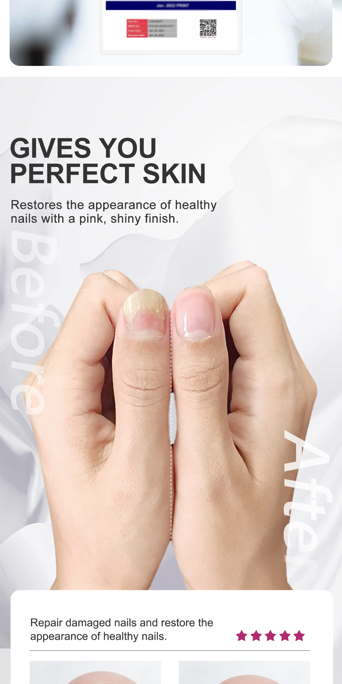 RtopR Ginger Antibacterial Nail Treatment Essential Anti Fungal ...