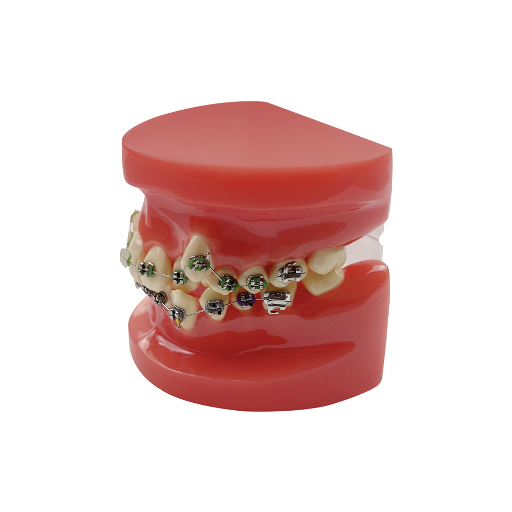 Dental Model Crowding Teeth Treatment Standard Teaching Model Dental ...