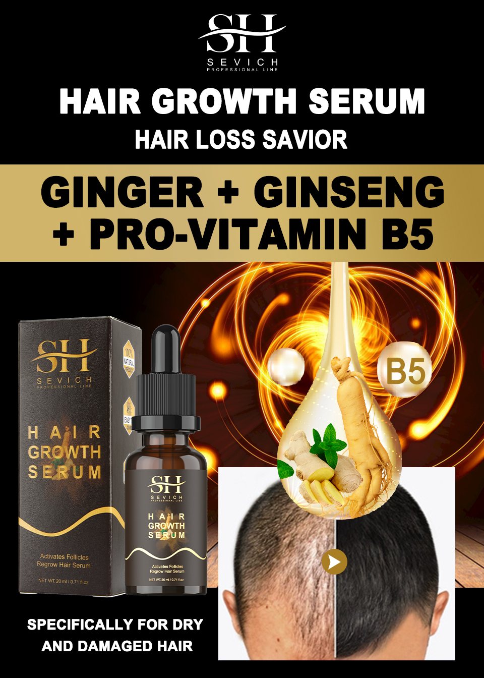 SEVICH Hair Growth Serum Hair Loss Hair Essence （20ml） | Shopee Philippines