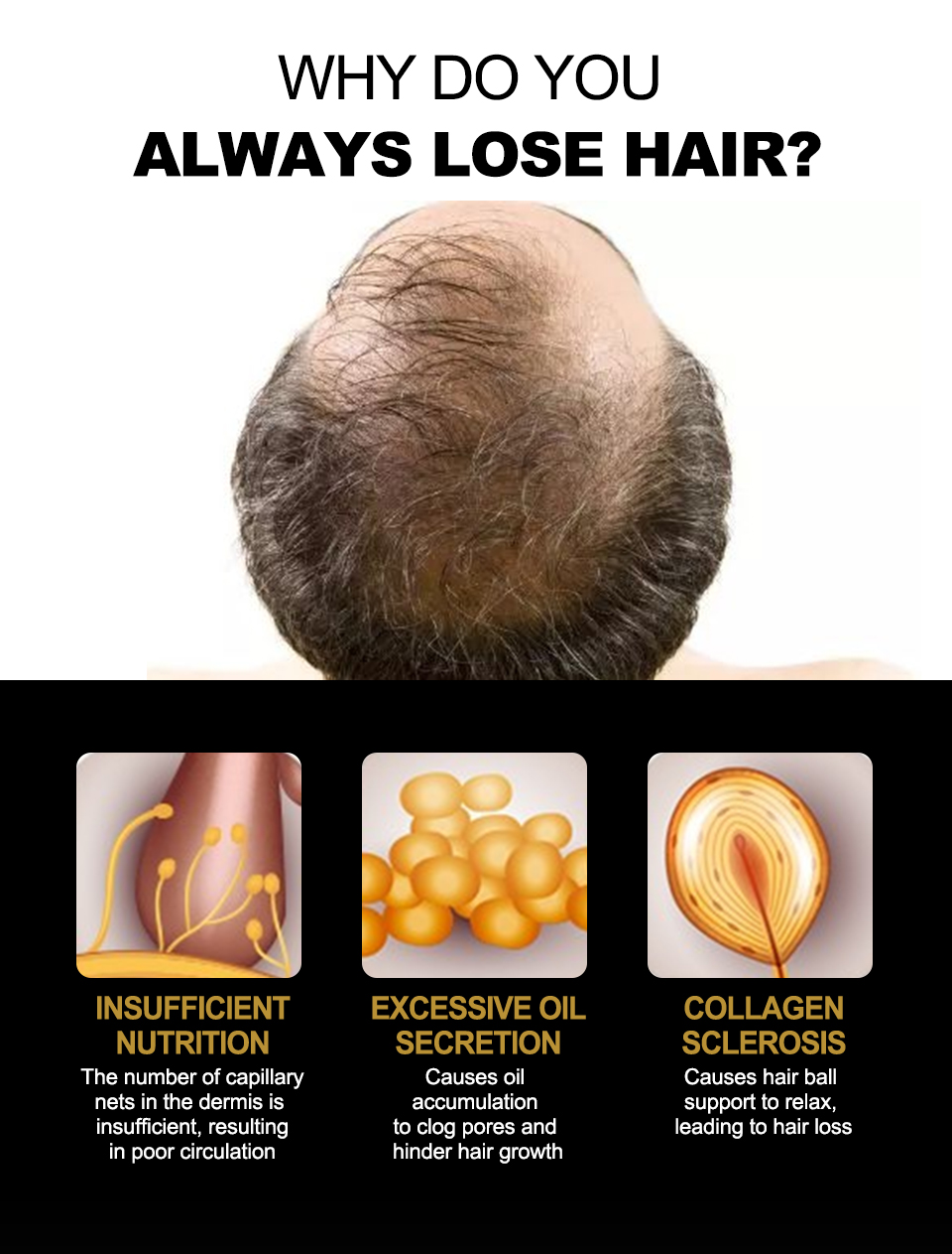 SEVICH Hair Growth Serum Hair Loss Hair Essence （20ml） | Shopee Philippines