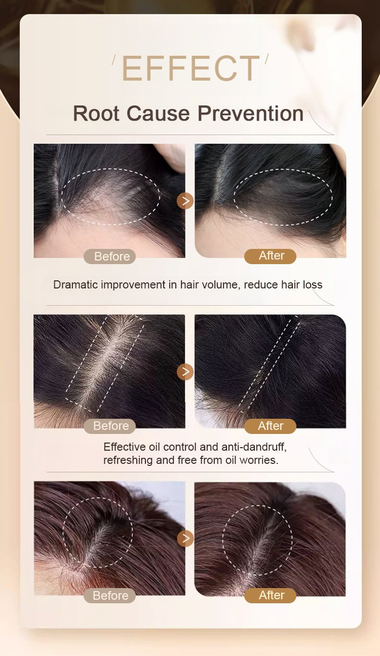 Buy 1 free 1 Ginger Plant Extract Anti-Hair Loss Hair Shampoo Hair ...