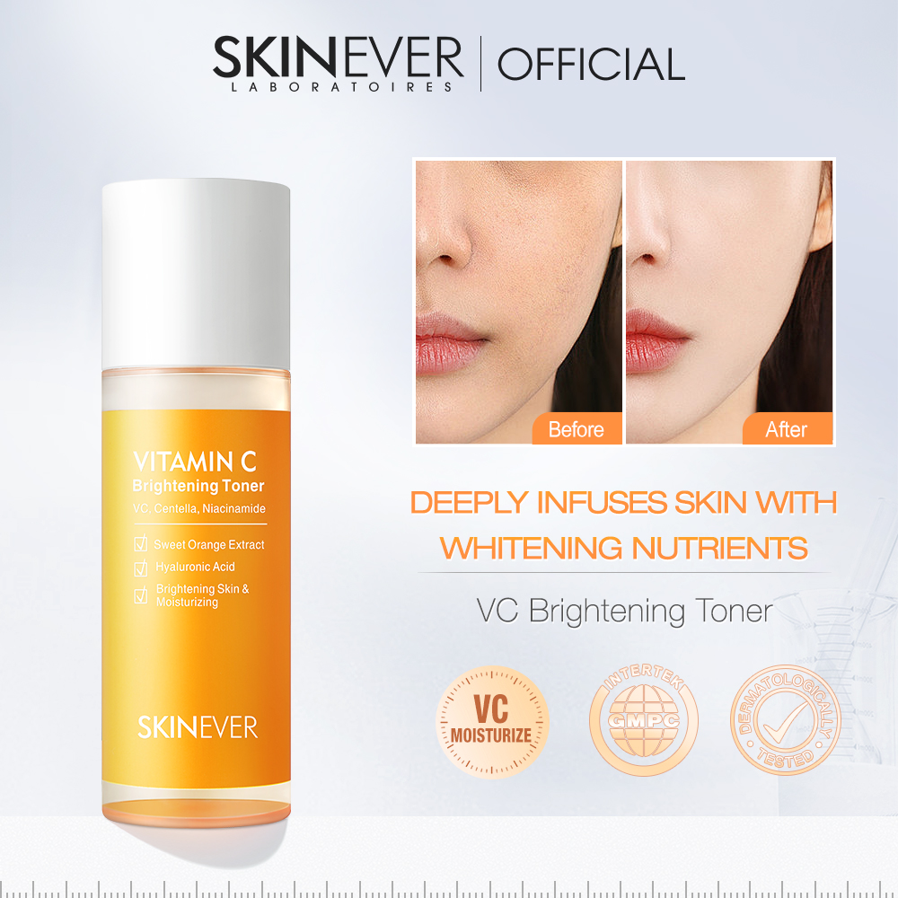 SKINEVER Vitamin C Whitening Toner Brightening Hydration Repairs The ...