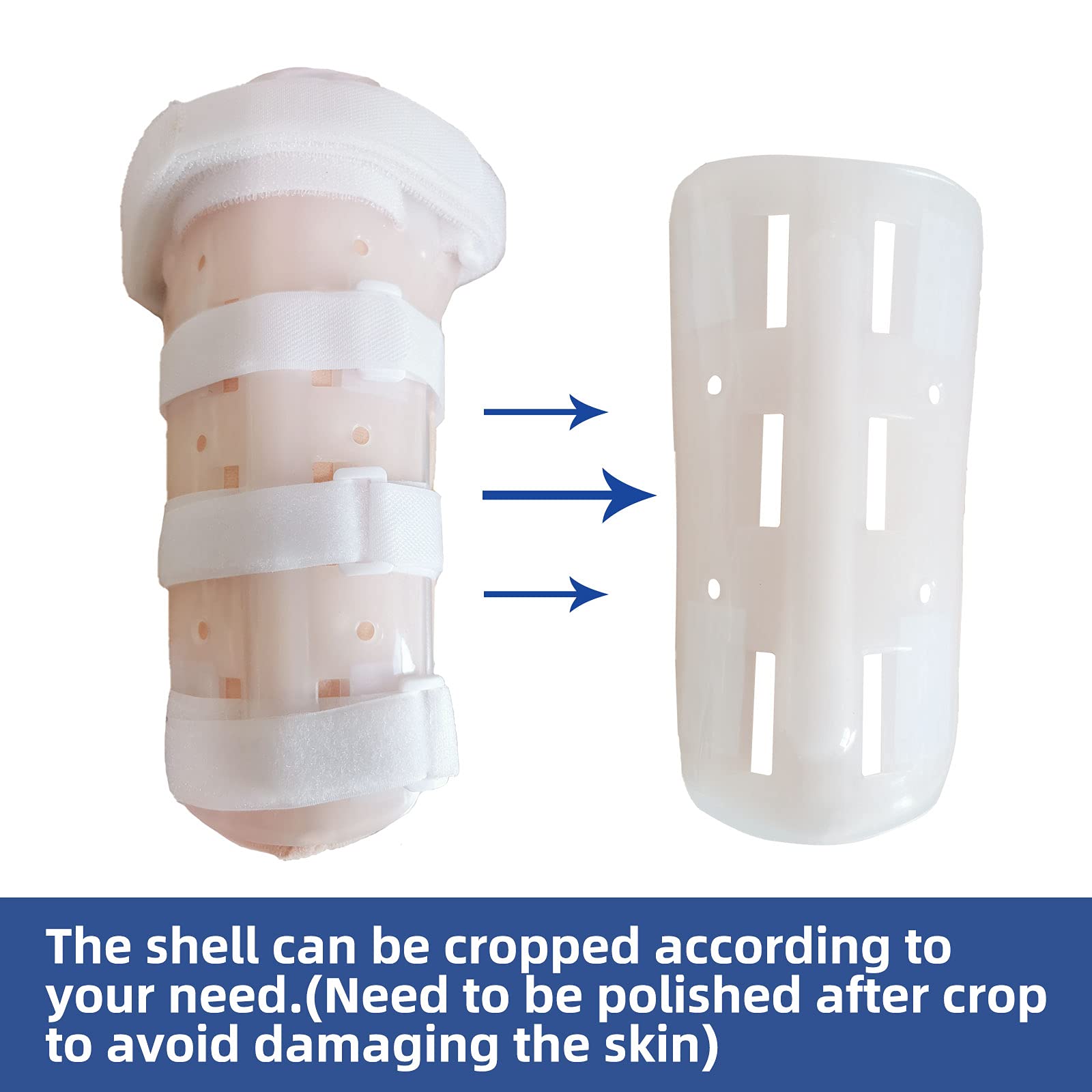 Sarmiento Brace - Humeral Shaft Fracture Splint Humerus Fracture Brace ...