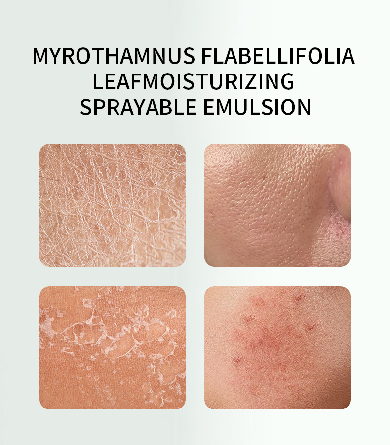 SHE Eureka Ultra facial moisturizer sprayable emulsion facial lotion ...