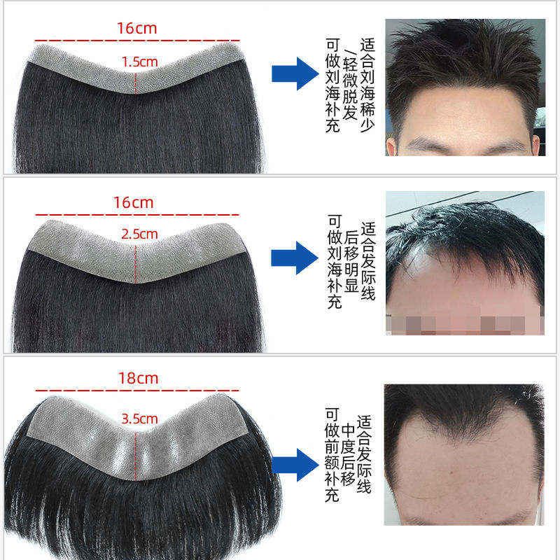 Wig Men's and women's hairline fake hair patch forehead Men's and women ...