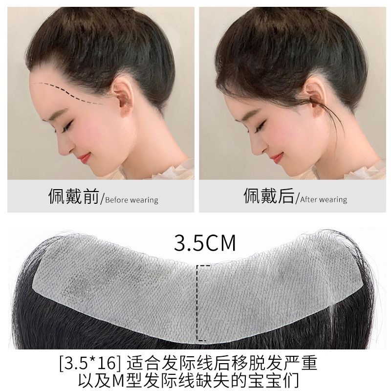 Wig Men's and women's hairline fake hair patch forehead Men's and women ...