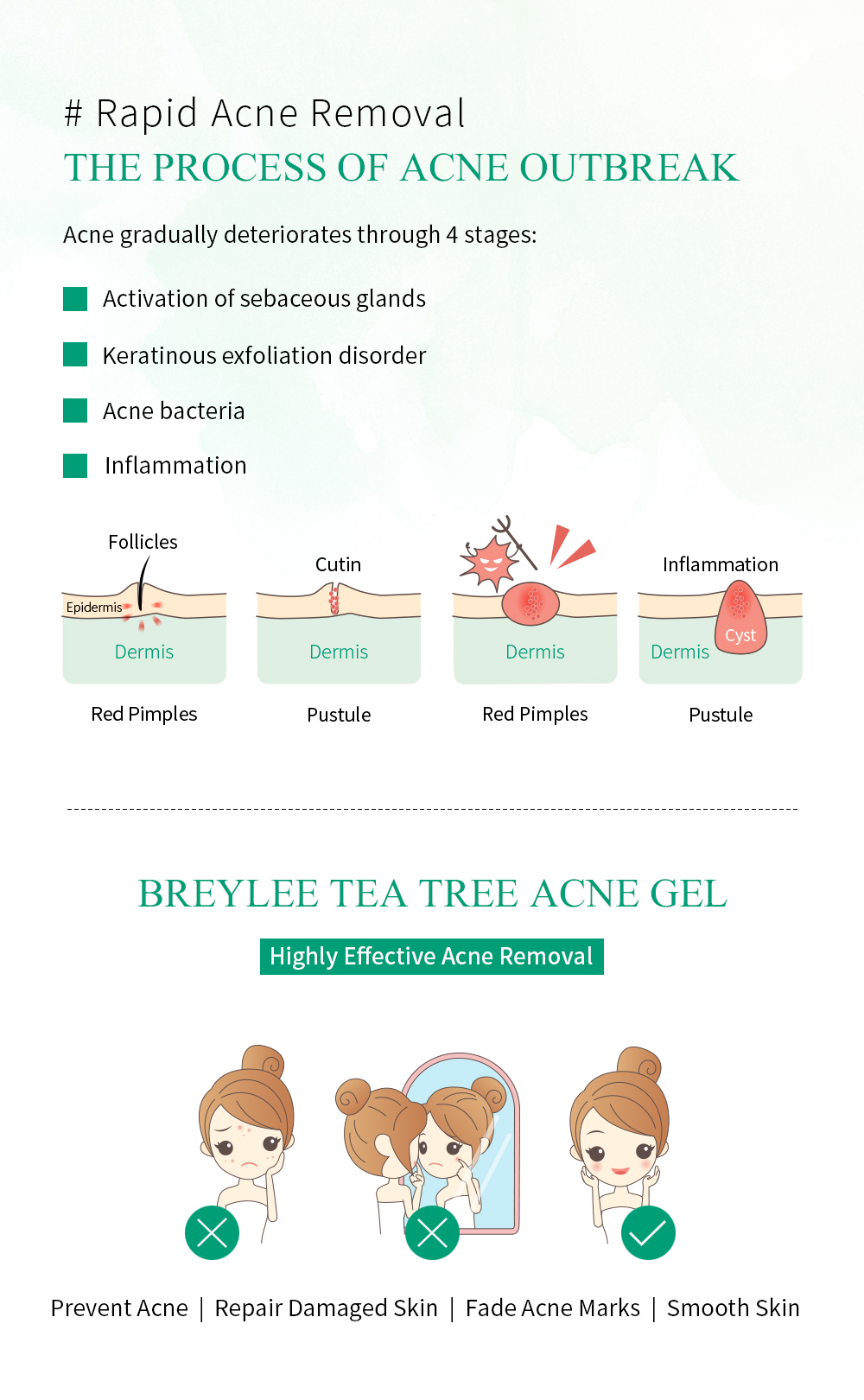 BREYLEE Acne Scars Gel Removal Redness Salicylic Acid Anti-Inflammatory ...