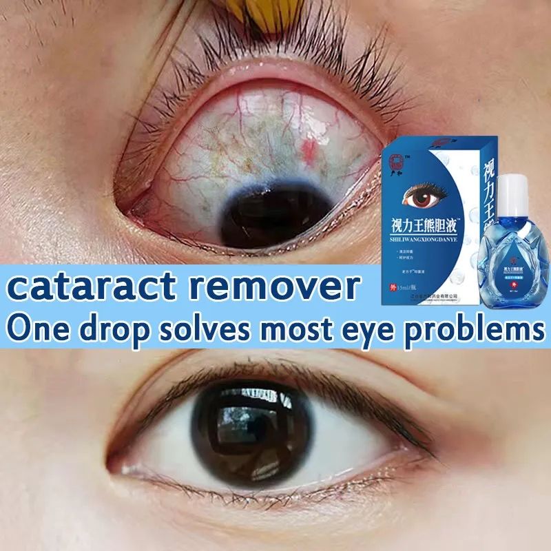 [BUY 1 TAKE 1]eye drops for Clear Vision Dry Eyes Congestion Eyes ...