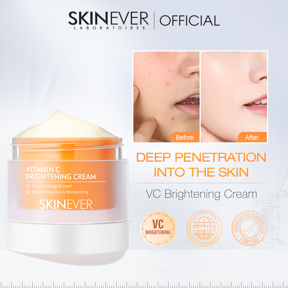 SKINEVER Vitamin C Set Whitening Facial Cleanser Moisturizing Toner ...