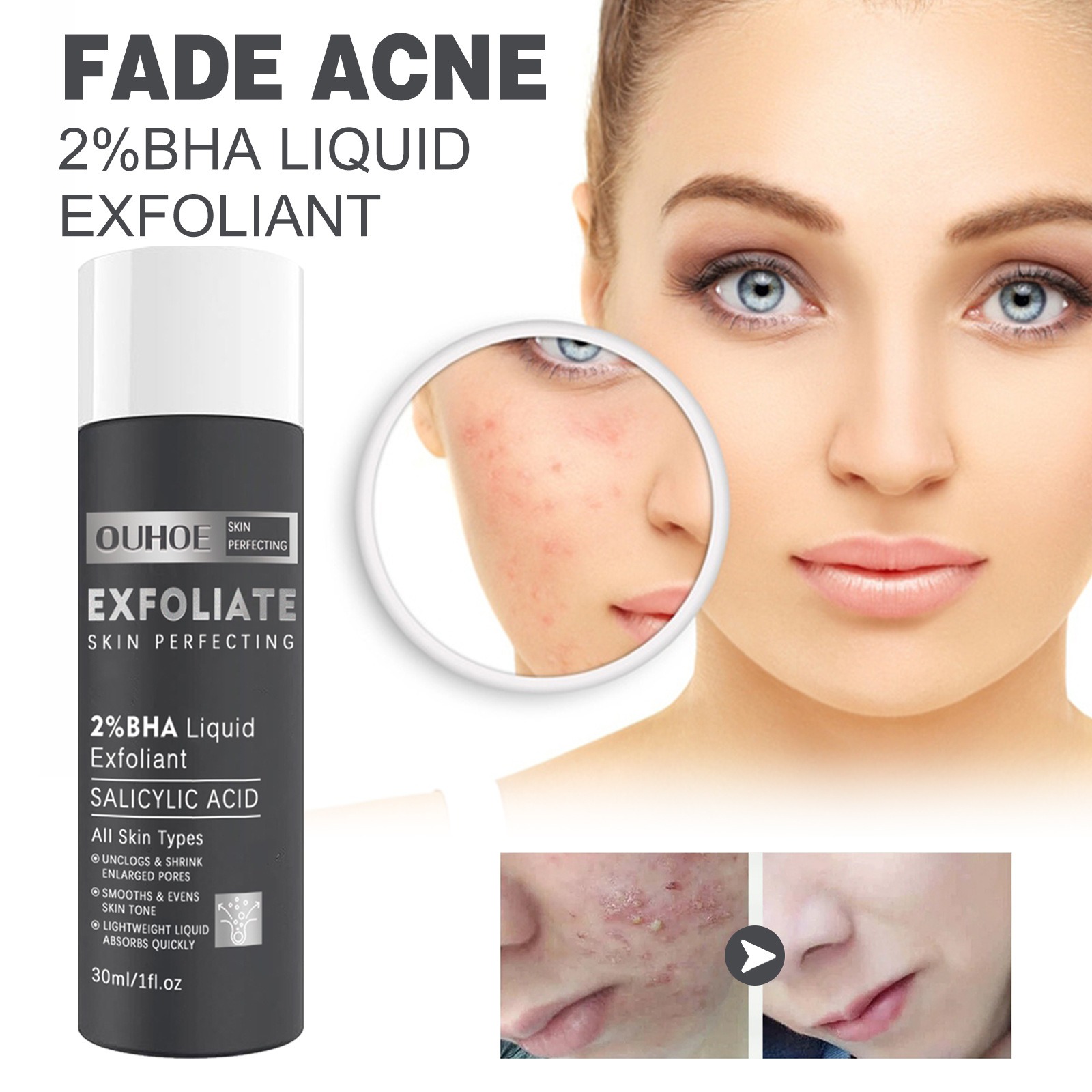 OUHOE Salicylic acid Serum 30ML 2% BHA Liquid Acne treatment ...