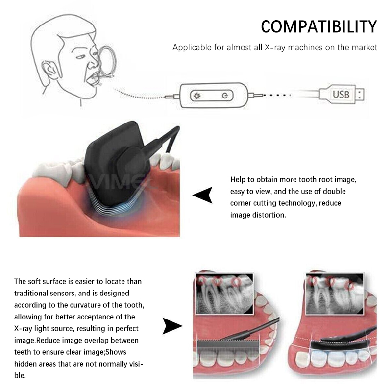 Dental Xray Sensor ECO Sensor Intraoral Digital X ray with Holders 2 ...