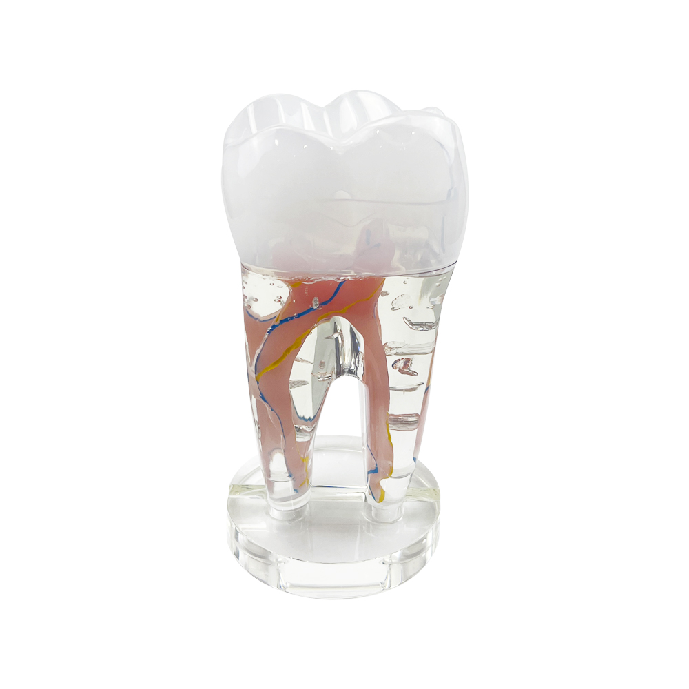 10 Times Endodontic Dental Model Detachable Teeth Model Large Clear ...