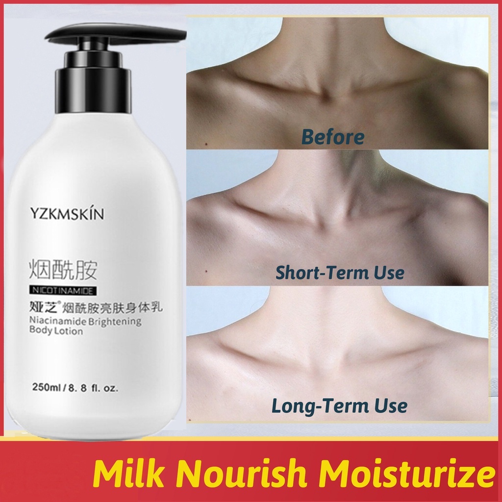 DEVNEN Niacinamide Whitening Body Lotion Moisturizing Skin Care Healthy Improve Lightening Dark ...