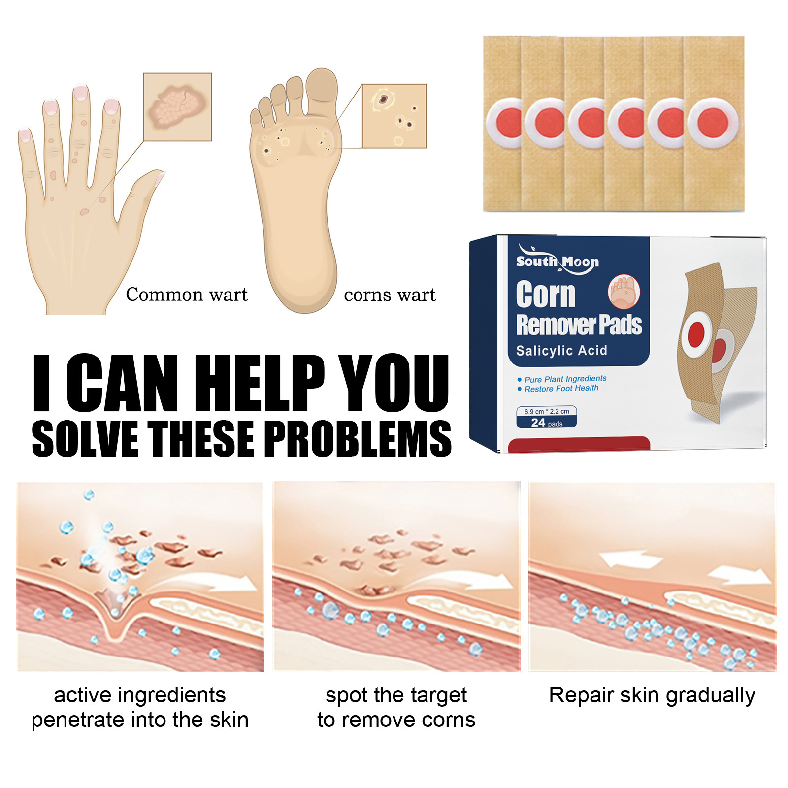 South Moon Medicated Wart Corn Remover - 24 Patches for Hand Foot Callus Treatment with ...