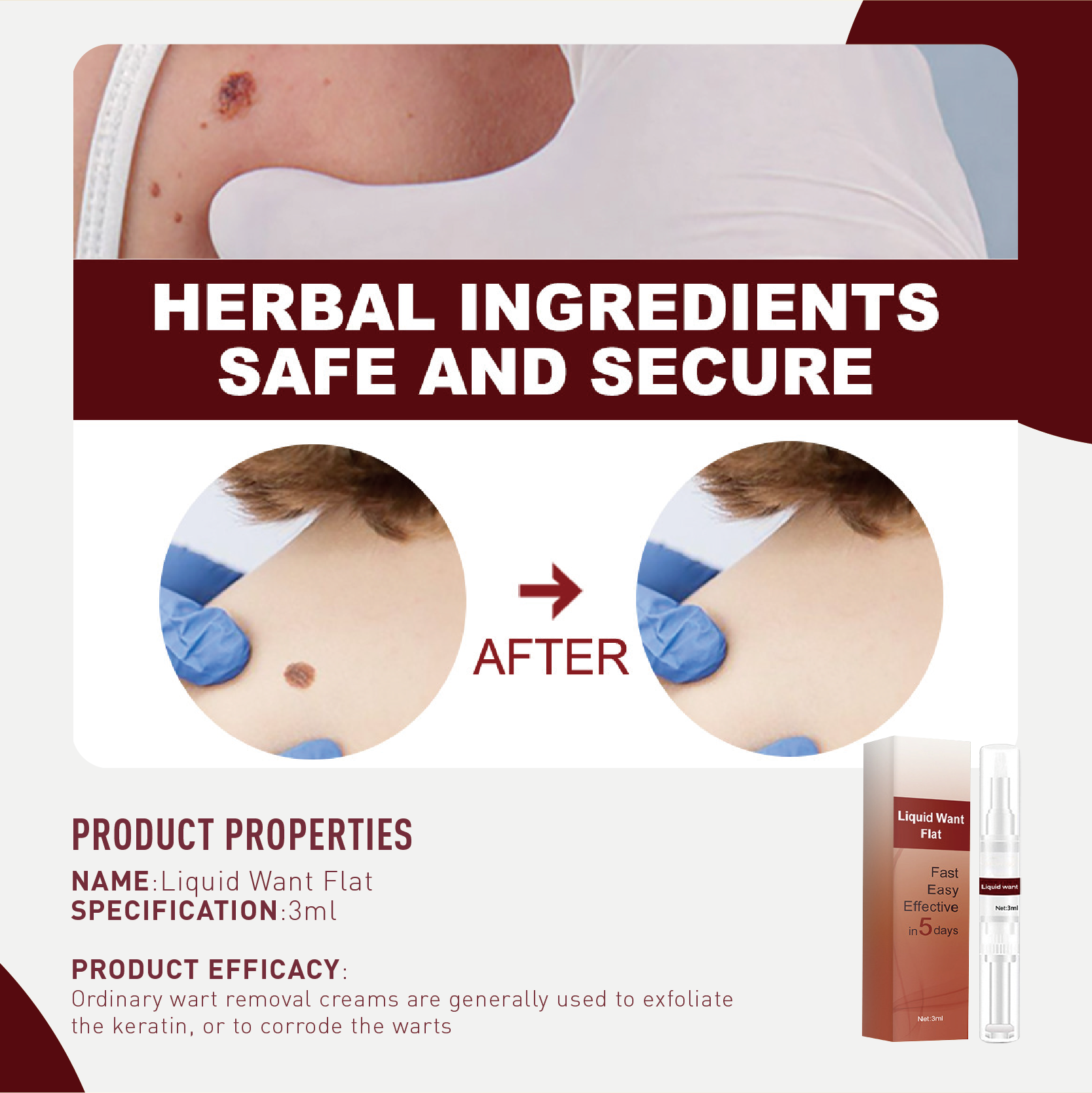 Remover Facial Skin Tag Removal Pen Foot Corn Plantar Wart Papillomas ...