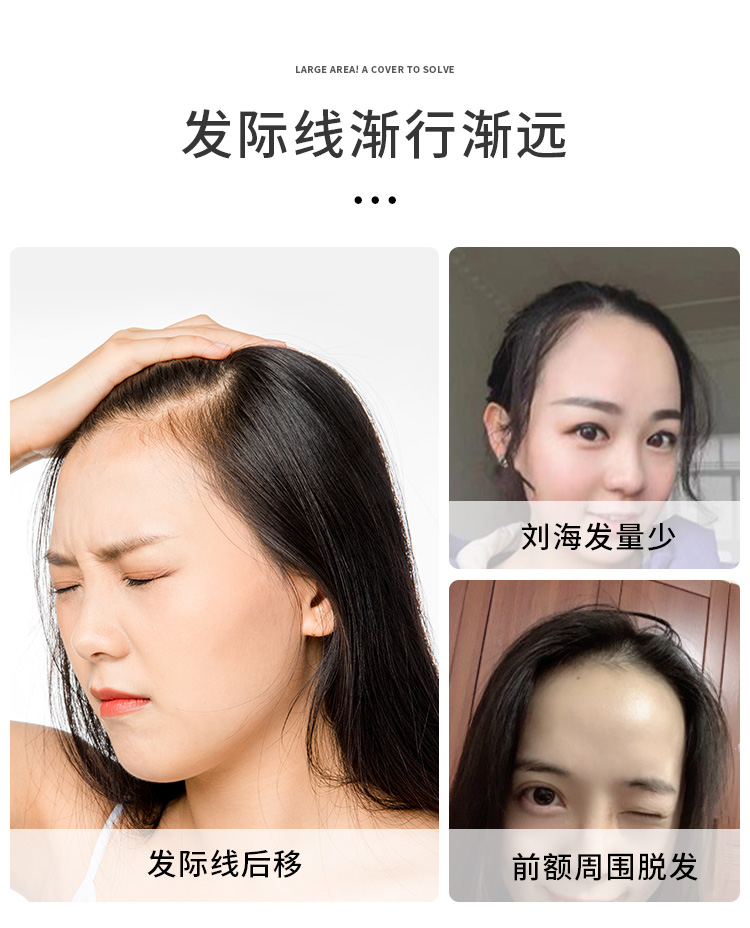 Men's and women's M-hairline fake hair patch bangs wig piece One-piece ...