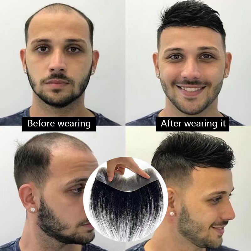 Hairline fake patch Invisible traceless air fringe wig Men's and women ...