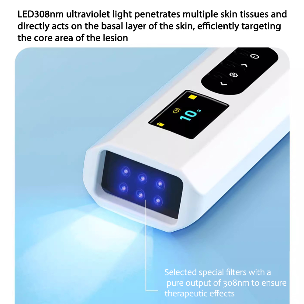 308NM UVB Phototherapy Lamp Device for Vitiligo Treatment UV Narrow Band Ultraviolet Light ...