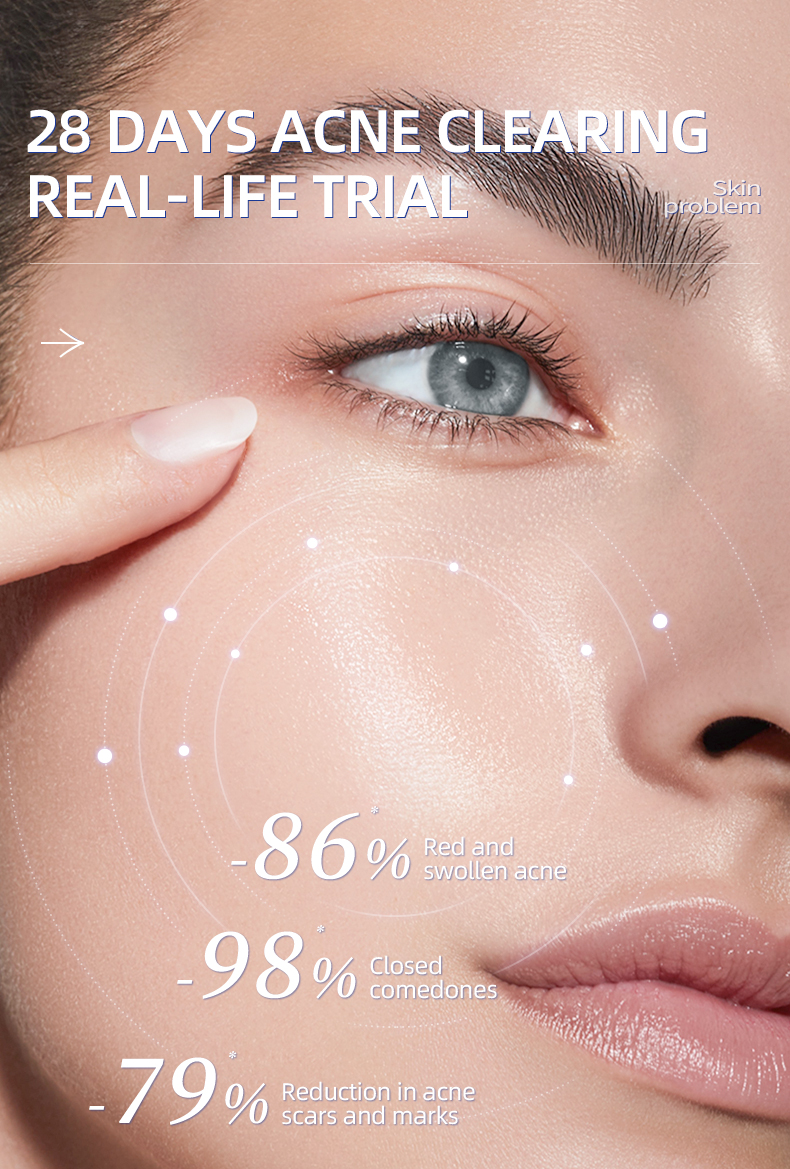 ICE LERSKIN Acne Essence Salicylic Acid Anti-acne Serum Lighten Acne ...