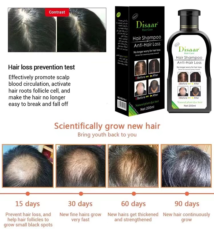【BUY 2 TAKE 1】Hot！Disaar Natural Plant Rapid Hair Growth Essential Oil ...