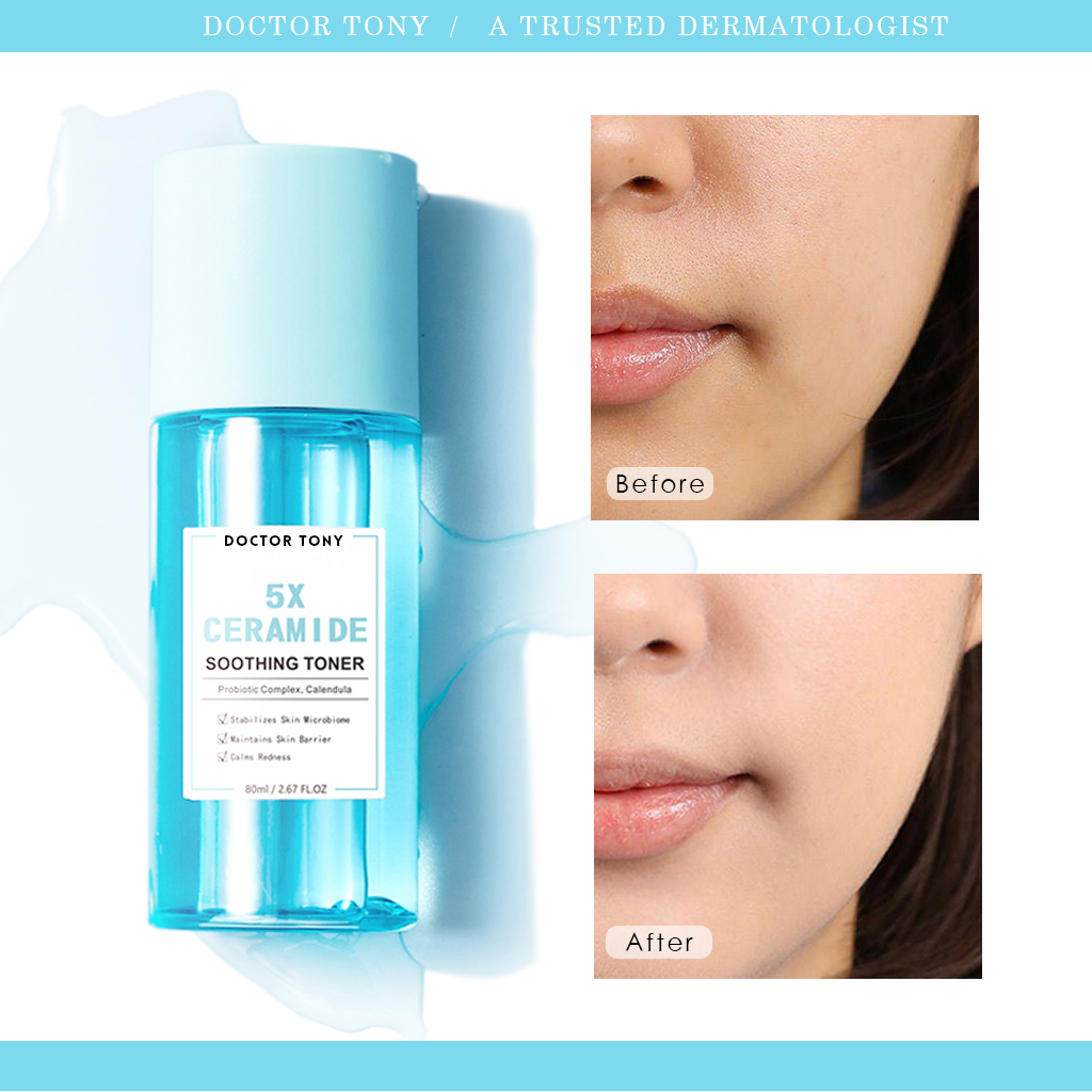 DOCTOR TONY 5x Ceramide Soothing Toner Skin Barrier Repair Toner With ...